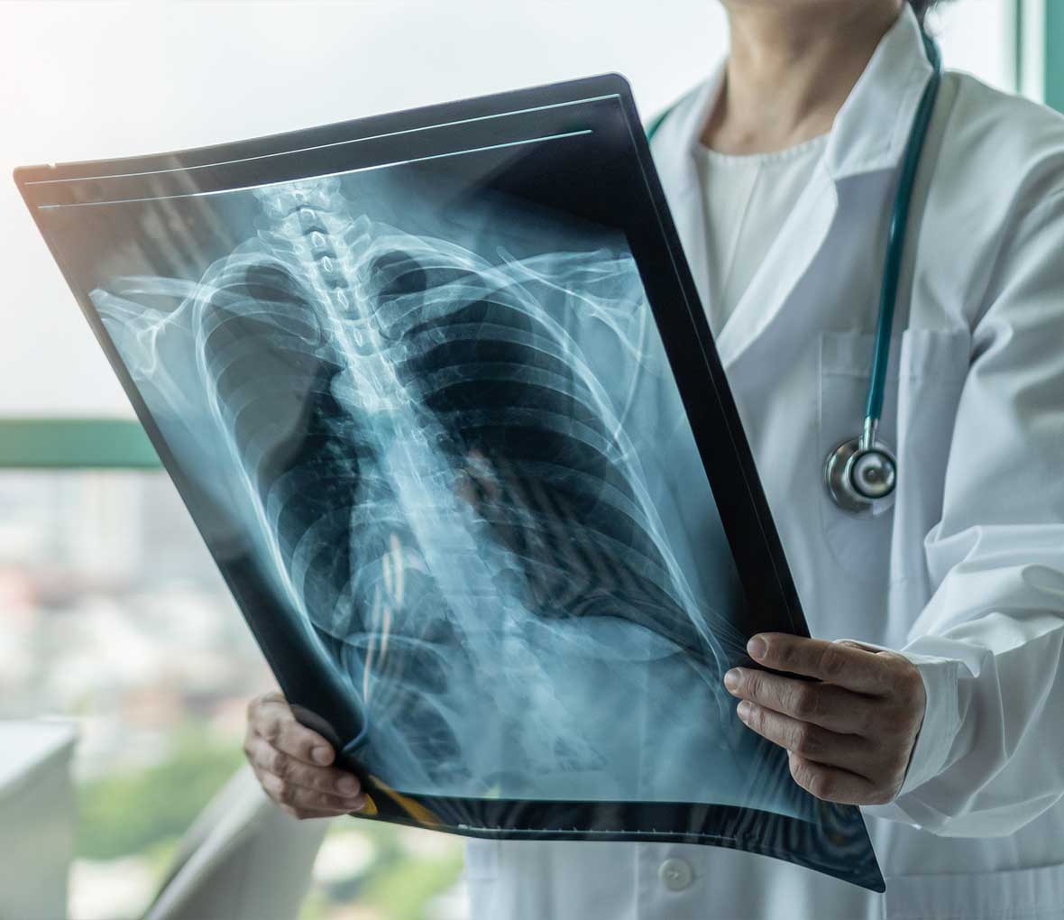 Diagnostics (Laboratory & Radiology) – VillaNove Hospital & One Day Surgery