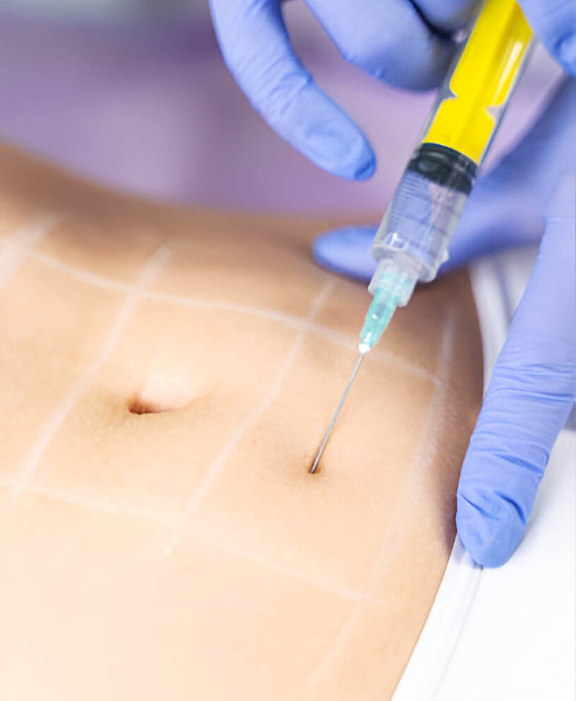 Non-Surgical Fat Reduction – VillaNove Hospital & One Day Surgery