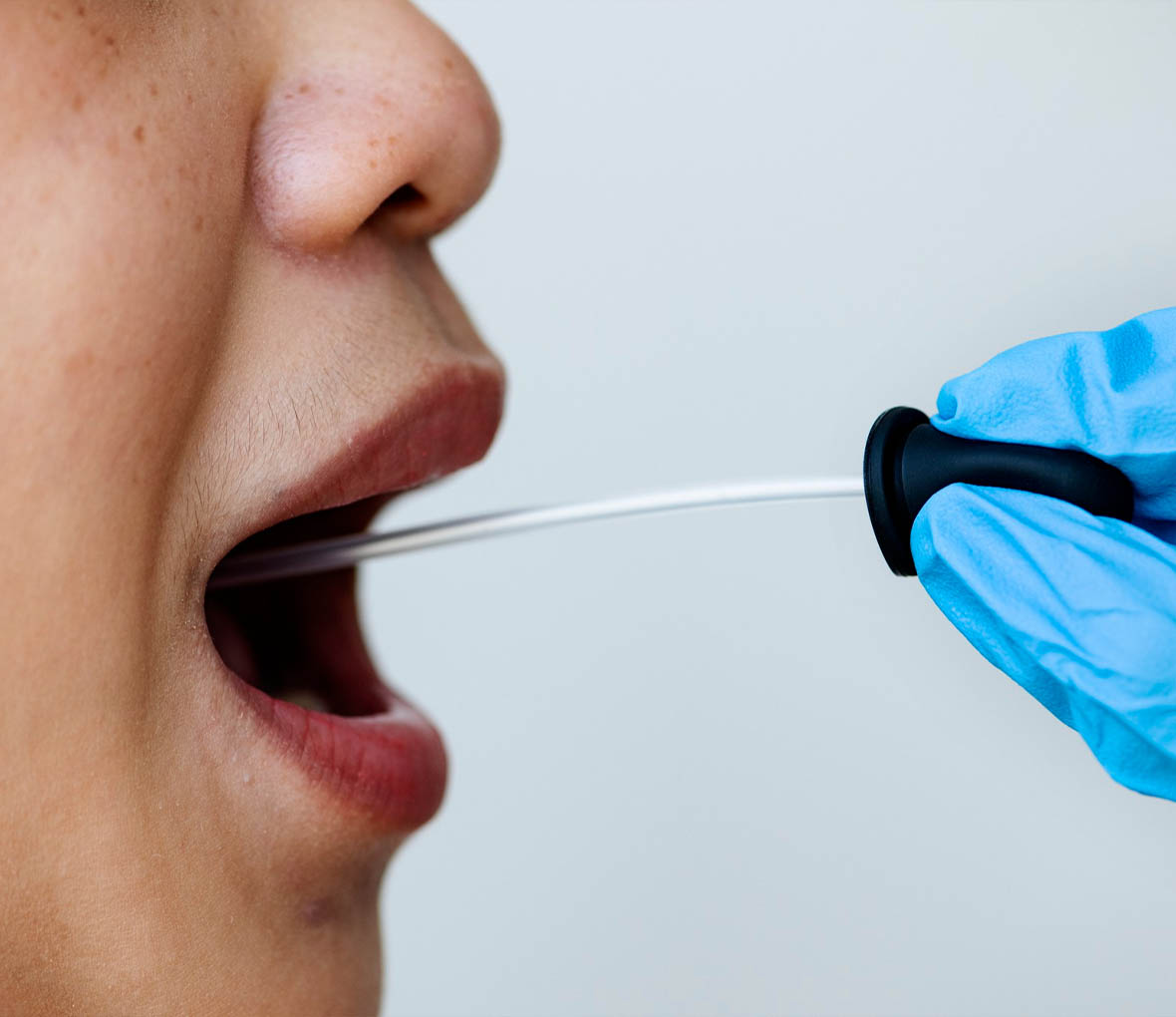 Tonsillectomy – VillaNove Hospital & One Day Surgery